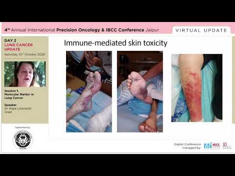 Part 6 - Immune related adverse events with PDL1 and ctla4 inhibitors - Dr. Raya Leibowitz, Israel
