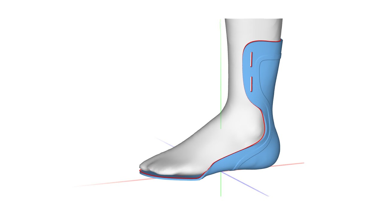 LeoAFO Templates and Features: Streamline Ankle-Foot Orthosis Design