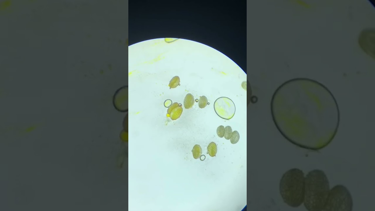 Your Allergies (Pollen) Under Microscope #science #microscopy #microscope