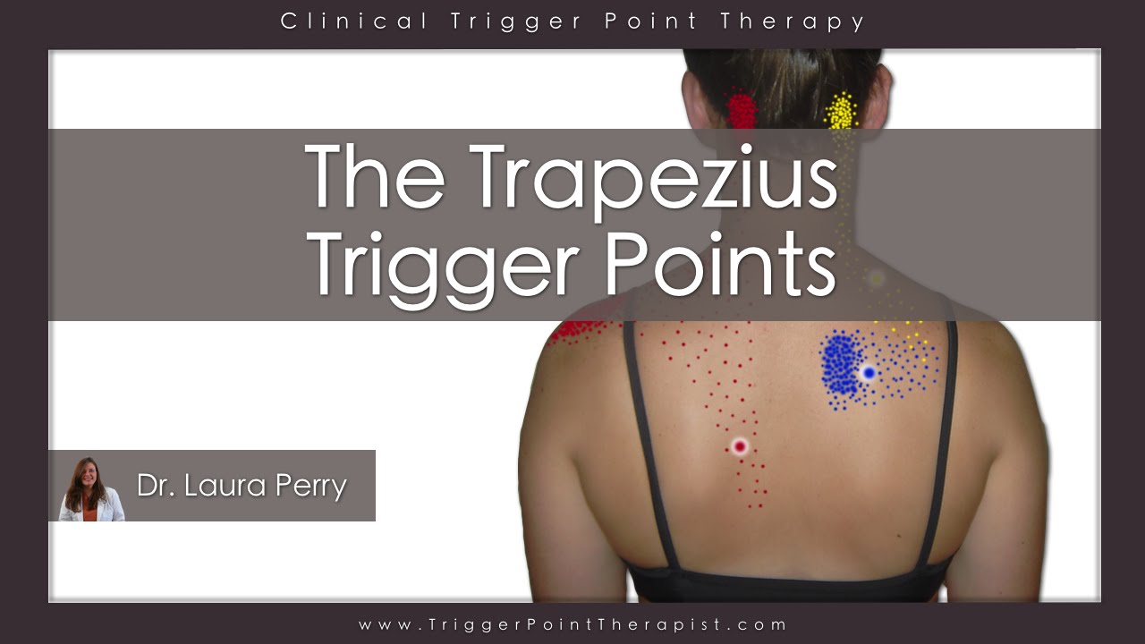 The Trapezius Trigger Points