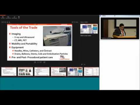Interventional Radiology At Cnhs Past, Present And Future Sharma, Yadav, Vellody 11 9 16 1