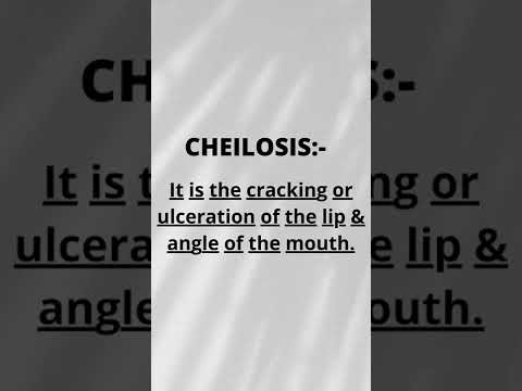 #cheilosis #lip #mouth #ulceration #medical #medicine #term