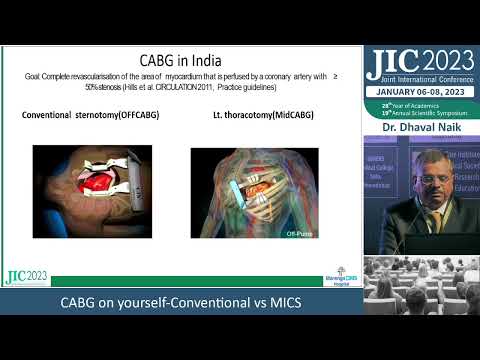 CABG on yourself -Conventional vs MICS | Cardiac | Dr Dhaval Naik