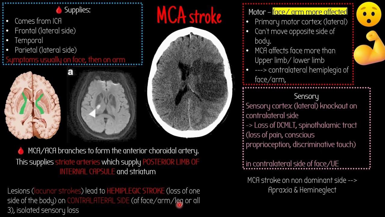 EVERY STROKE YOU NEED TO KNOW + IMAGING | NSB