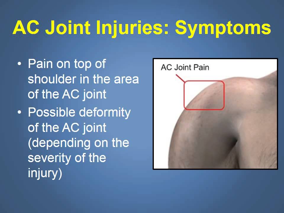 AC Joint Injuries Described by a Phoenix Sports Medicine Orthopedic (480)219-3342