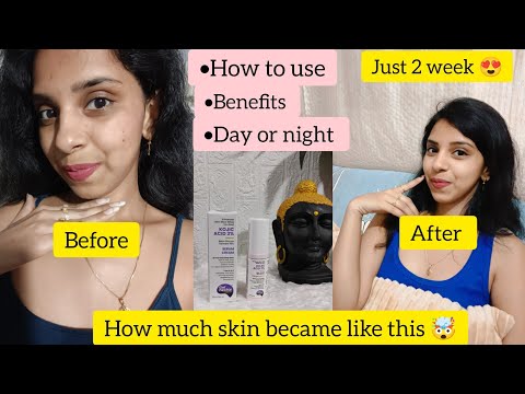 Get Nectar Happiness Glow Serum – Pharmacy Grade | Remove Dark Spots | Kojic Acid | Niacinamide