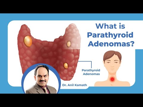 What is Parathyroid Adenomas | Symptoms and Treatment | Dr. Anil Kamath Surgical Oncologist