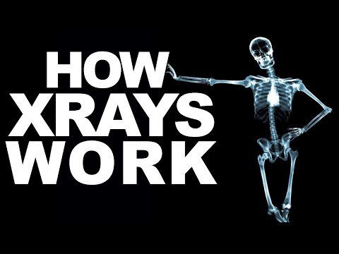 X-rays: The Inside Story