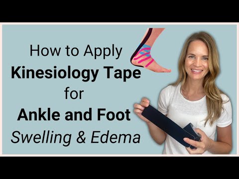 How to Apply Kinesio Tape to an Ankle and Foot for Swelling