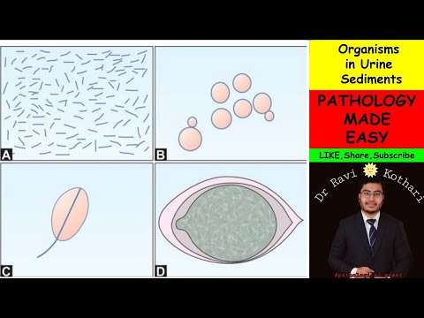 Organisms in Urine | Trichomonas Vaginalis | Bacteria | Yeast | S. Haematobium | Microfilaria