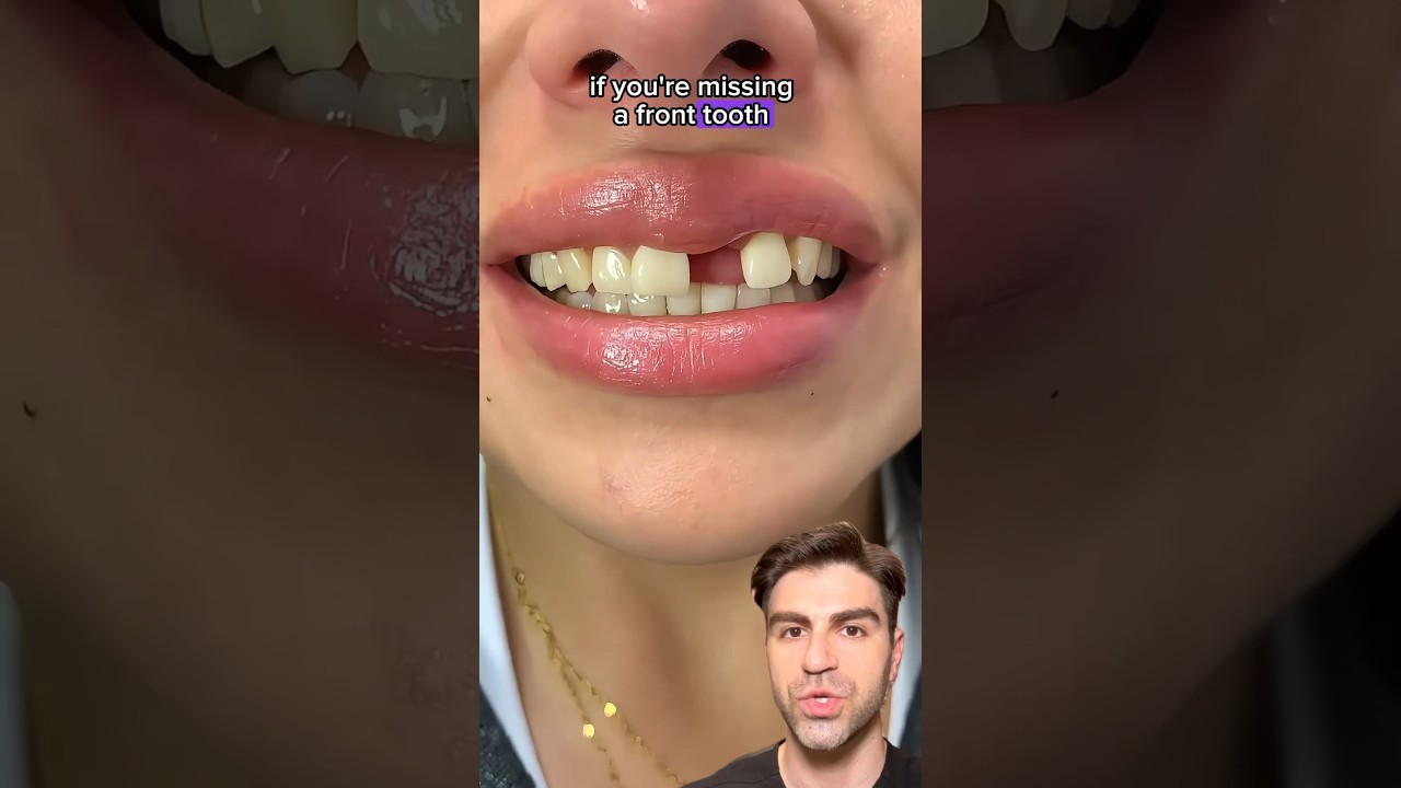 Missing Tooth? Discover Instant Confidence Magic!