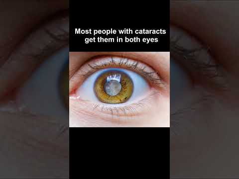Blurry Vision in One Eye - Cataract