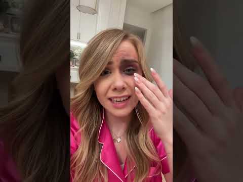 MY BEST FRIEND PUNCHED ME IN THE FACE...