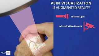 NextVein Handheld Vein Visualization Finder System V800NV