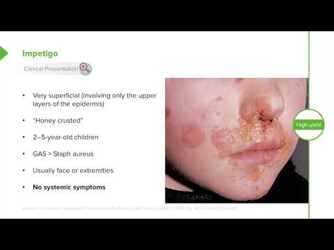 29 Skin and Soft Tissue Infections SSTI in Children Pathology, Clinical Presentation & Diagnosis 2