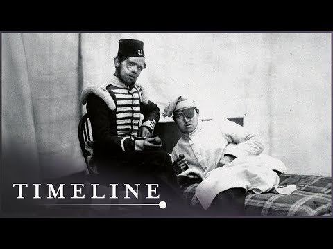 Battle Photographs From The Brutal Crimean War | Timeline