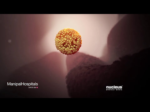 Introduction To Stem Cells | Bone Marrow Transplant In India | PBSCT | Manipal Hospitals.