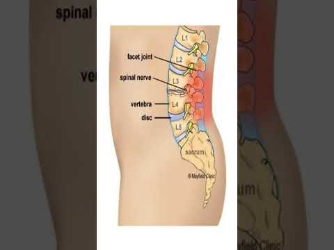 Understanding Lower Back Anatomy – Lumbar Spine & Nerve Pathways