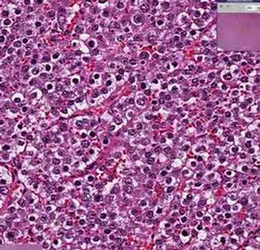 Histopathology Testis-- Seminoma