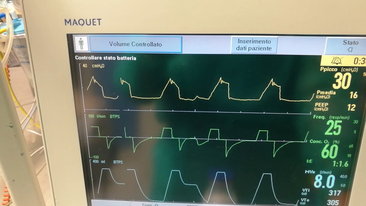 Clinical examples: Reverse trigger