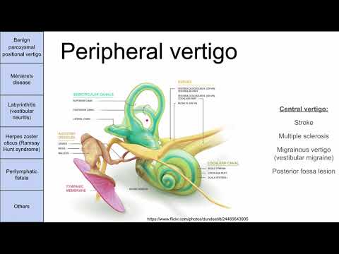 Vertigo Perifer – Bhyllabus l'énigme