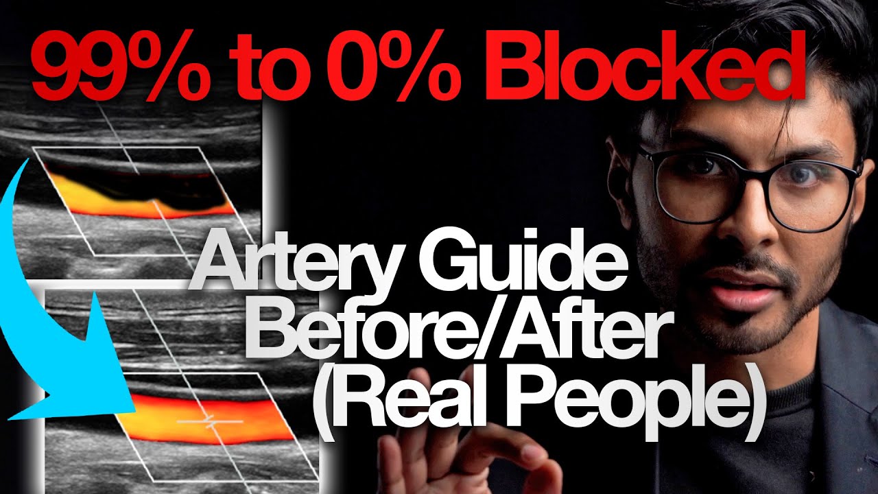 Revolutionary Artery Cleaning Method: Real-Life Success Stories and ...