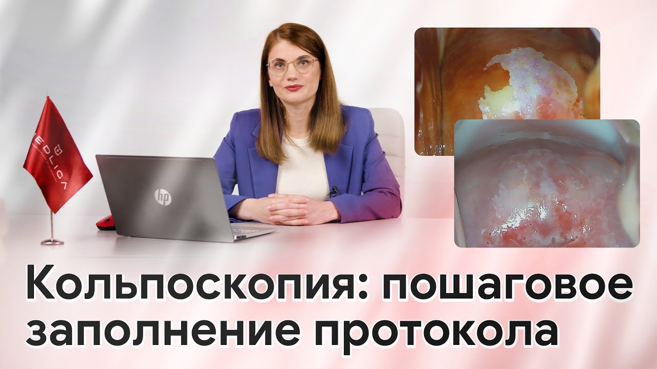 Заполнение протокола кольпоскопии и кольпоскопическое заключение в ...