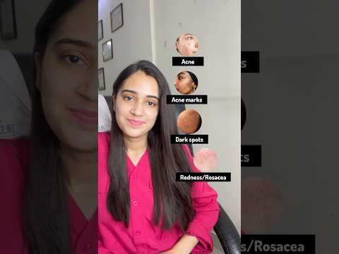 Azelaic acid| Skincare| Dark spot treatment | Acne treatment | Rosacea #skincare
