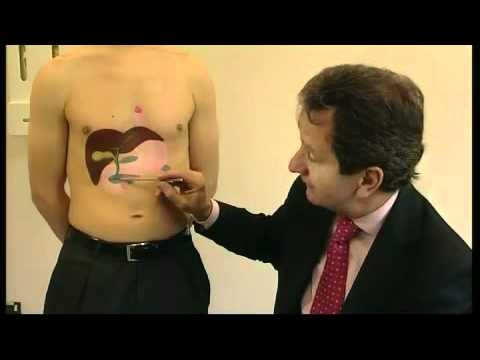 GALLSTONES - A Guide for Patients,  Part 1