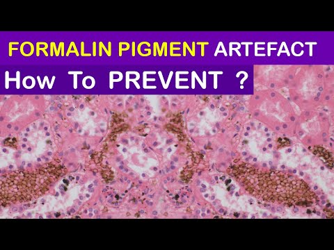 How To PREVENT FORMALIN PIGMENT ARTIFACT ? ( Histology Q&A )