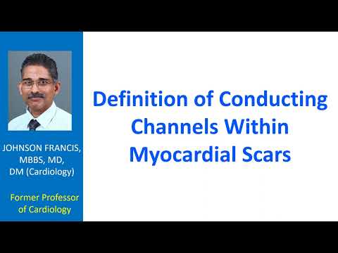 Definition of conducting channels within myocardial scars