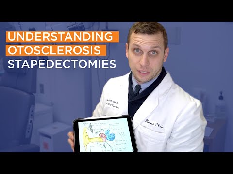 Understanding Otosclerosis Part 5 | What is a Stapedectomy?