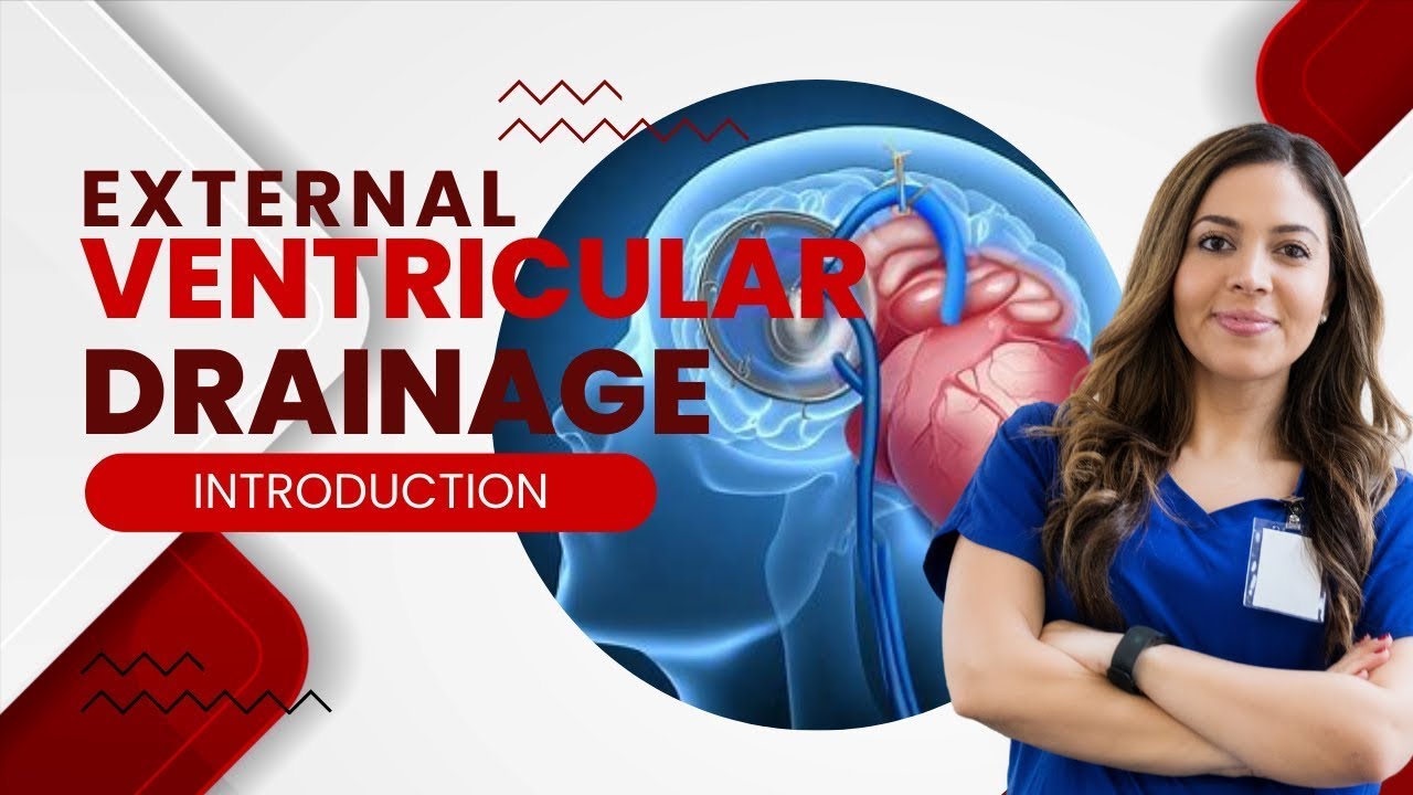 Mastering External Ventricular Drainage: Your Ultimate Guide!