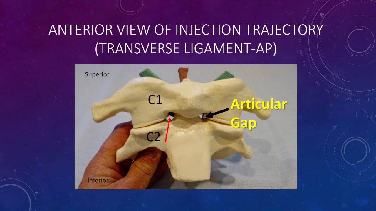 Craniocervical Instability ~ Non-surgical CCI Treatments ~ CCJ Institute