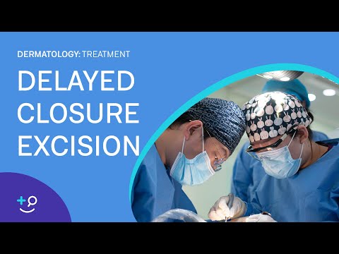 Delayed Closure Excision [Dermatology]