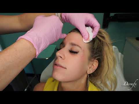 XEOMIN vs BOTOX: What is it?