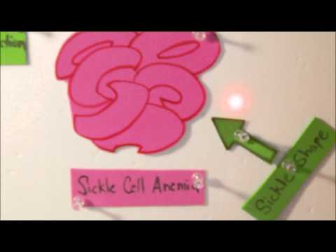Anemia NCLEX Review