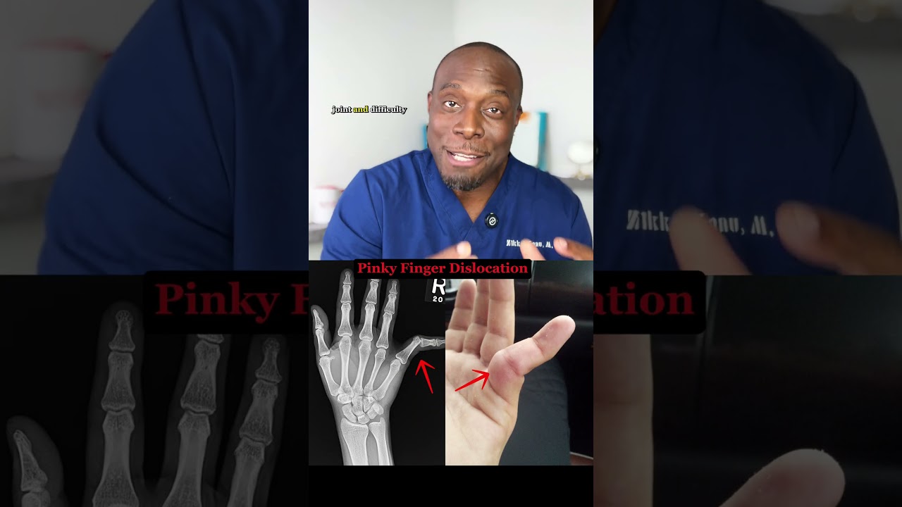 Bone Fracture vs Dislocation: What’s the Difference?