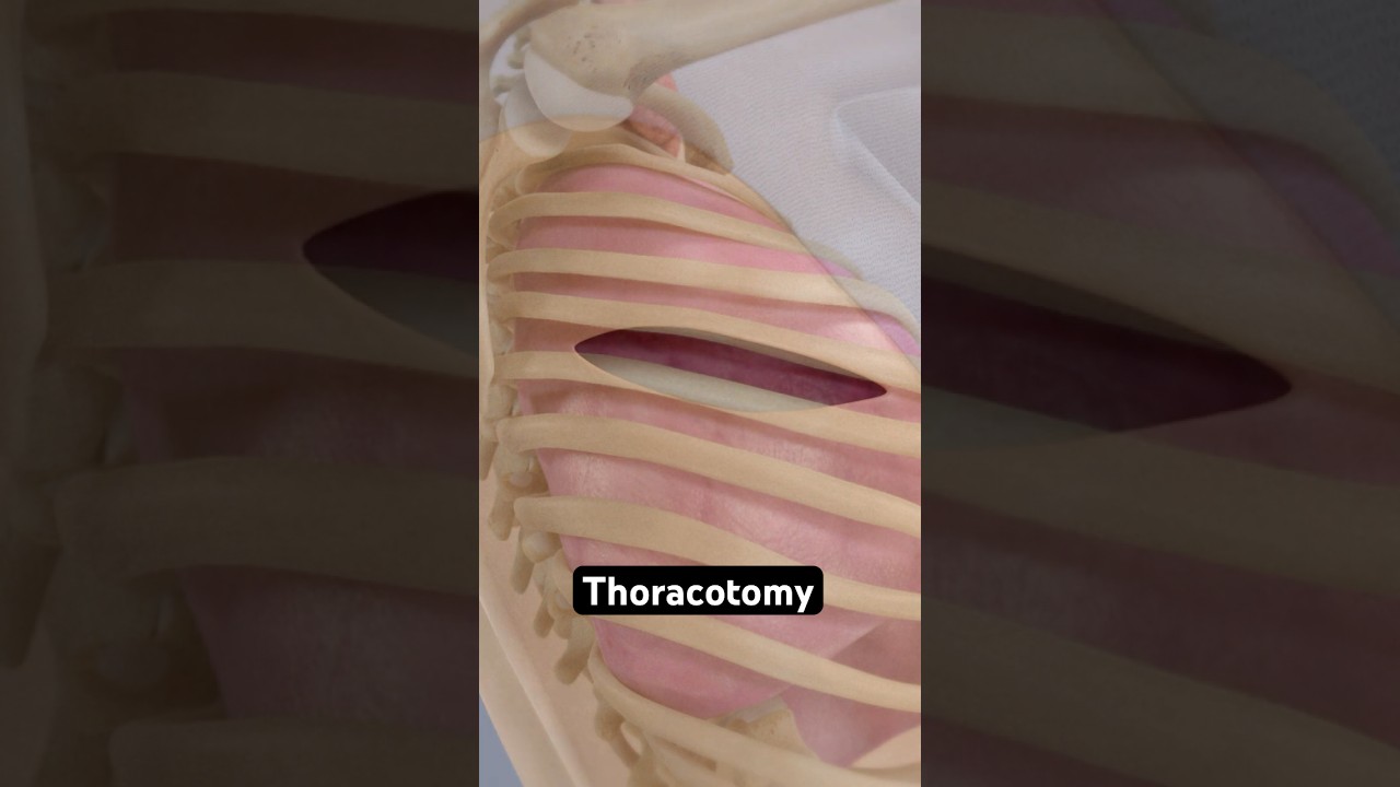 How surgeons get behind your ribs (3D Animation)