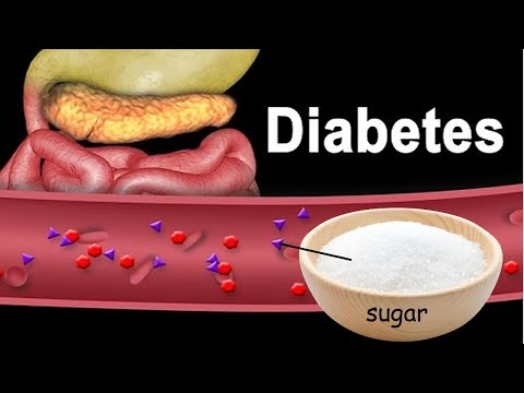 American Sign Language ASL Video Dictionary - diabetes