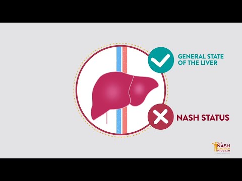 Imaging techniques in NASH diagnosis: non invasive but not ideal