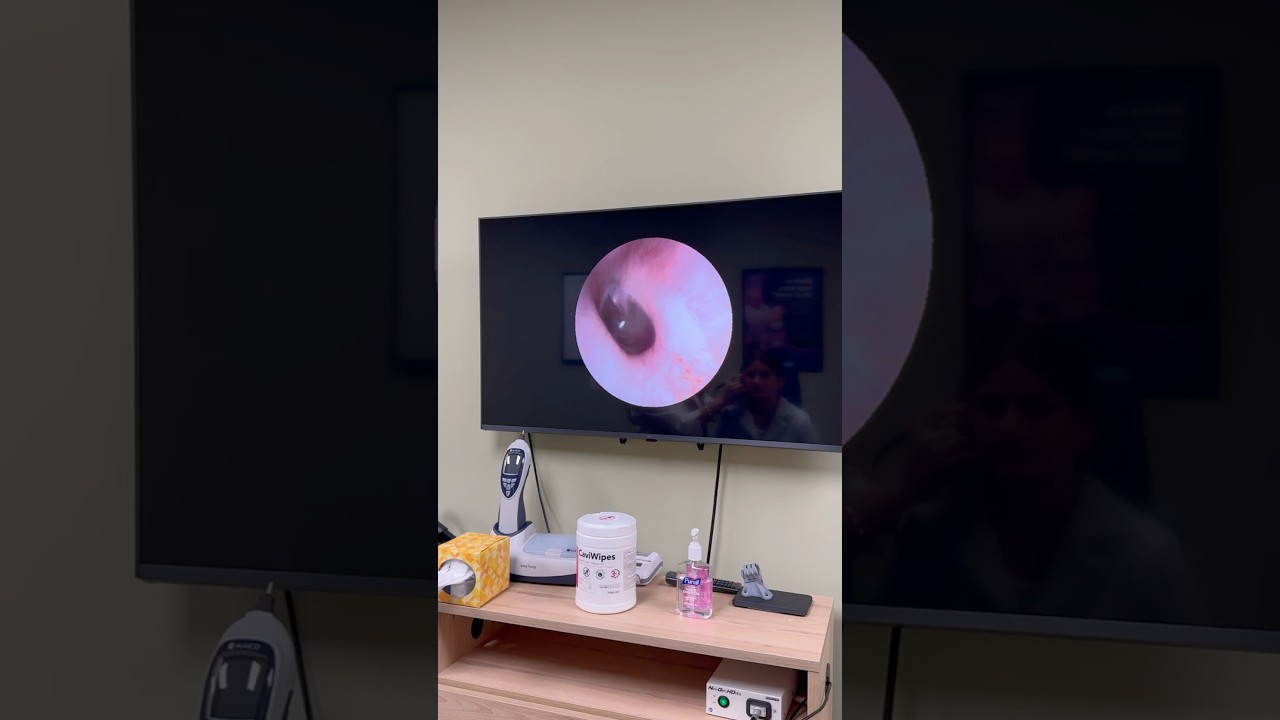 Did you know this is what your eardrum looks like? 👂🥁 #eardrum #hearing #earcare #ear #drum