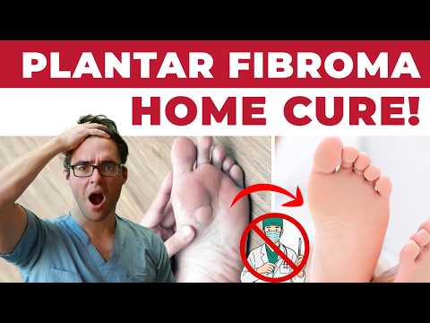 Hard Painful Knot On Bottom Of My Foot | Michigan Podiatrist