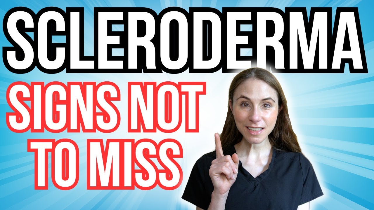Signs Of Scleroderma NOT TO MISS