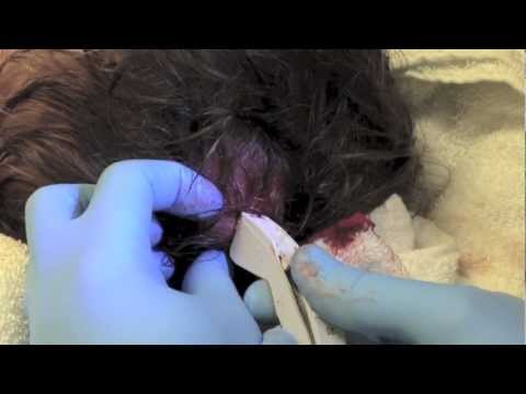 scalp laceration fixed with staples