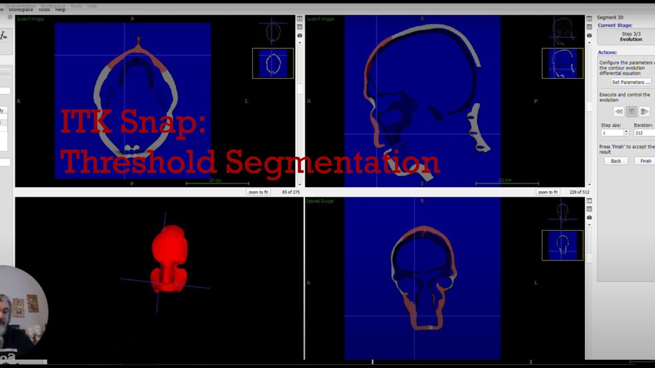ITK Snap Threshold Segmentation