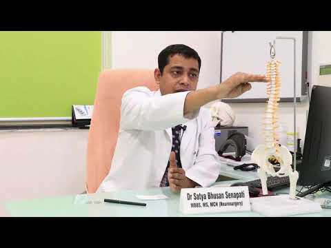 Common Neurological Problem & When to Consult a Neurologist.