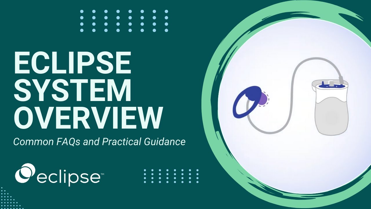 Eclipse System Overview: Common FAQs and Practical Guidance