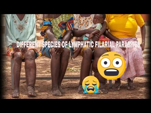 Lymphatic Filariasis: Different Species Of Parasites