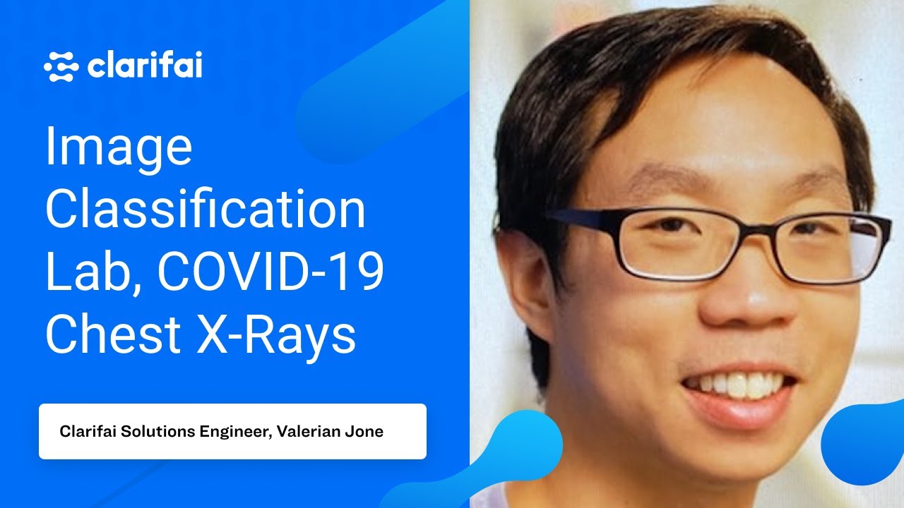 Image Classification Lab, COVID 19 Chest X Rays | Valerian Jone | Clarifai
